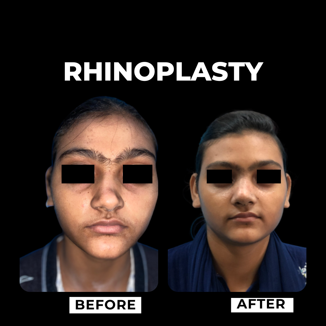 The Best ENT & Cosmetic Surgery Clinic - Eveite