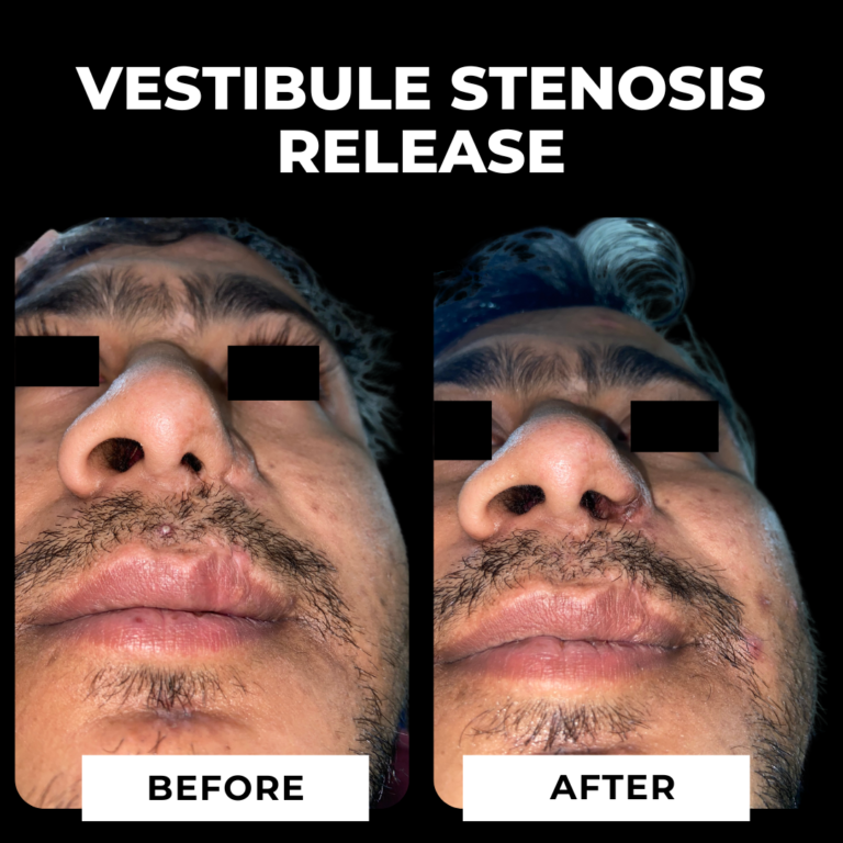 The Best ENT & Cosmetic Surgery Clinic - Eveite